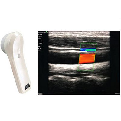4D wireless Probe Ultrasound Handheld Scanner - Motorized Stair Chair